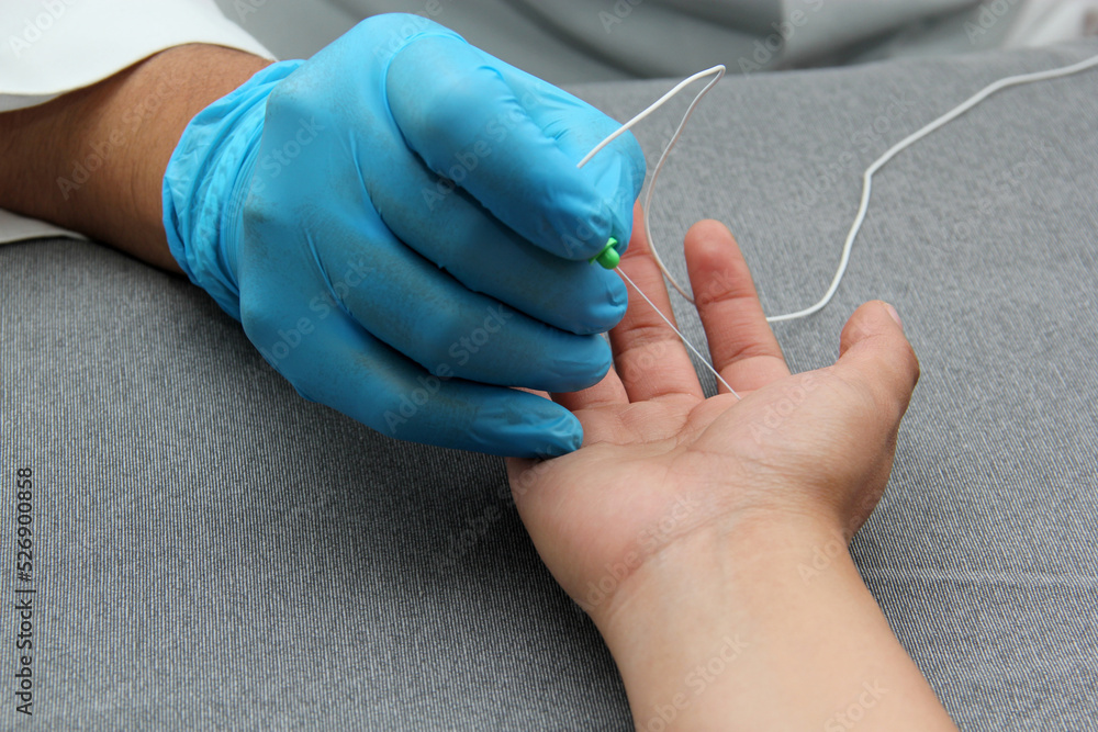 Electromyography is a graphic recording technique of the electrical ...