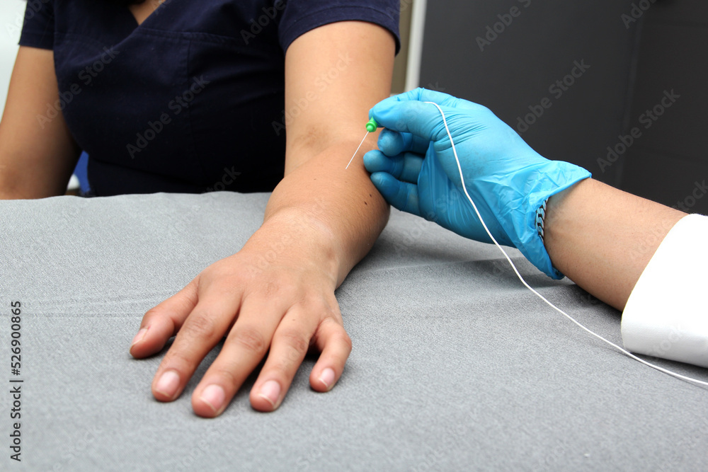 Electromyography is a graphic recording technique of the electrical ...