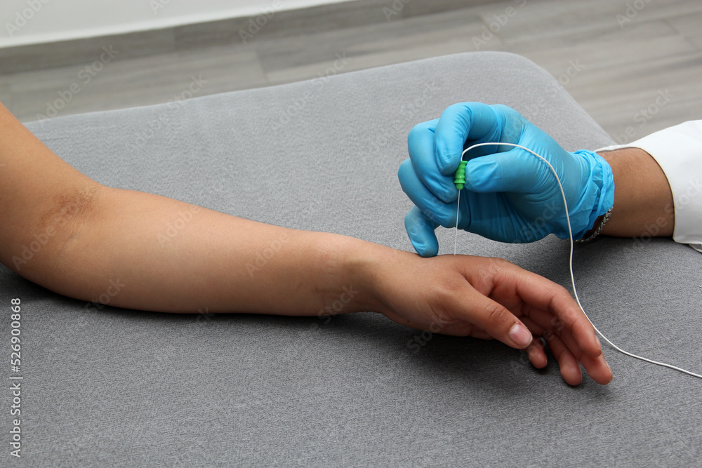 Electromyography is a graphic recording technique of the electrical ...
