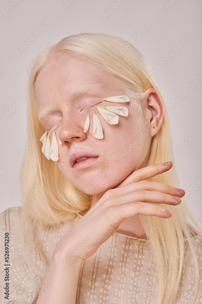 Portrait of albino girl posing at camera with petals on her natural ...