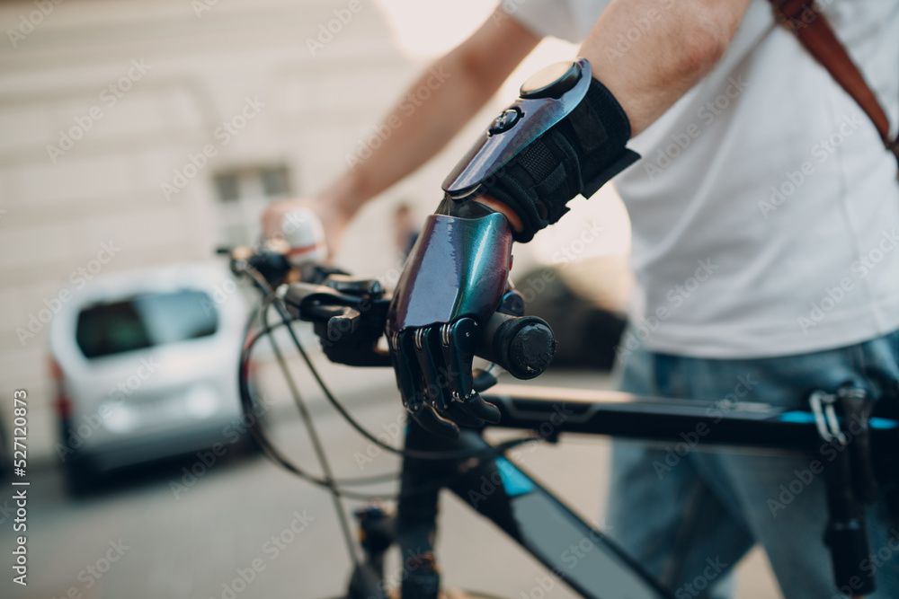 Young disabled man with artificial prosthetic hand in casual clothes ...