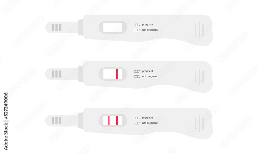 Set of modern pregnancy test results vector illustration. Pregnancy ...