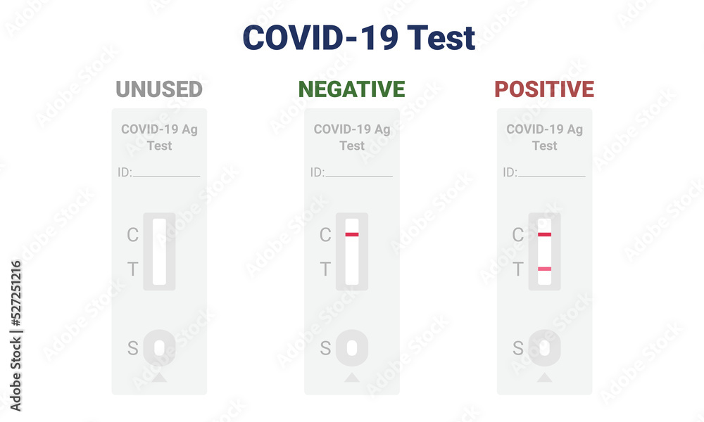Set of COVID-19 rapid test kit showing different results top view flat ...