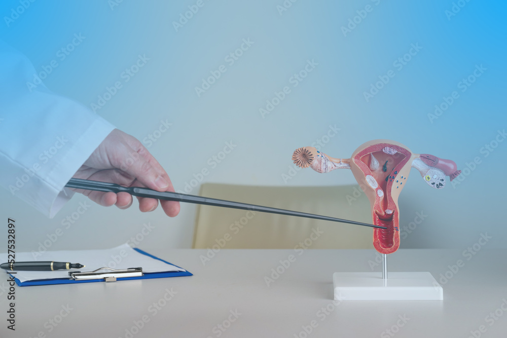 doctor gynecologist pointing model of female reproductive system on his ...