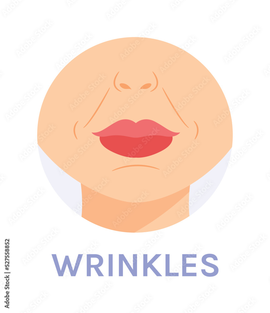 Nasolabial Facial Wrinkles. Skin Problem. Marionette Wrinkles Near the ...