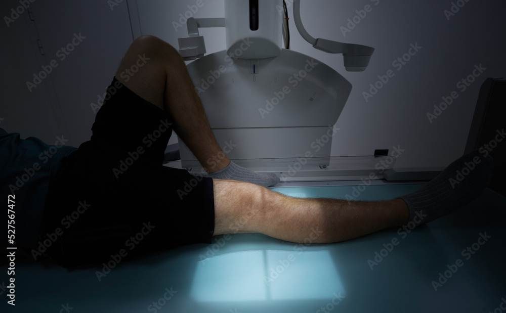 Patient's knee X-ray, close-up. X-ray procedure after injury knee or ...