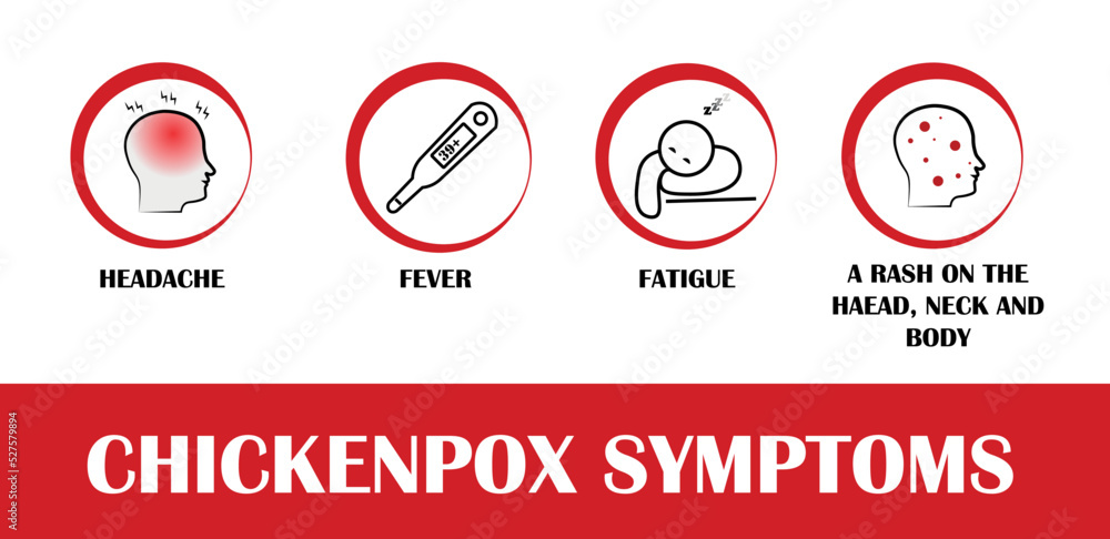 chickenpox symptoms, Pictograms with names of individual symptoms Stock ...