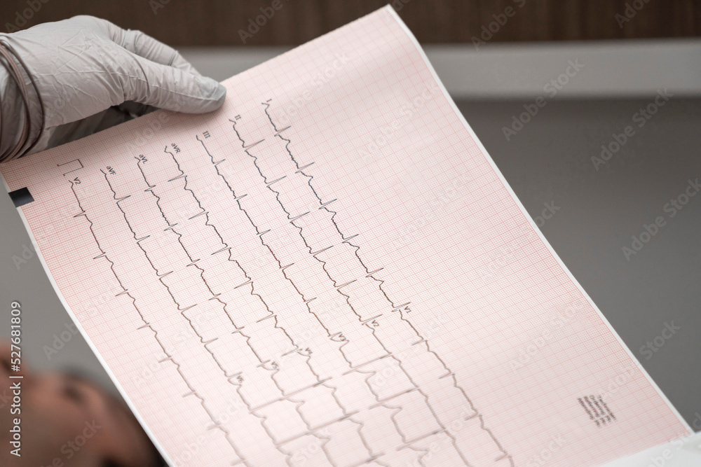 Electrocardiogram, ecg in hand, palm of a doctor. Medical health care ...