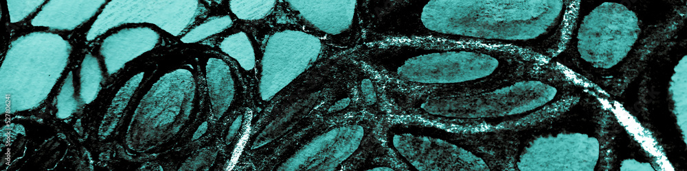 Dividing Cell Cancer. Sage Germs 3d. Seafoam T Cells Lymphocytes. Coli ...