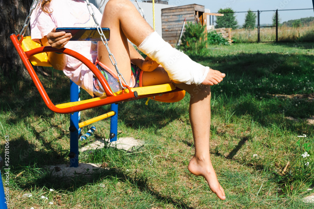Children's legs are bandaged in plaster - barefoot on a swing ...