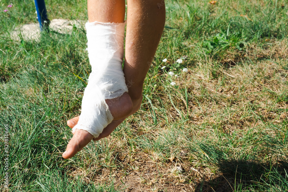 Children's legs are bandaged in plaster - barefoot on a swing ...
