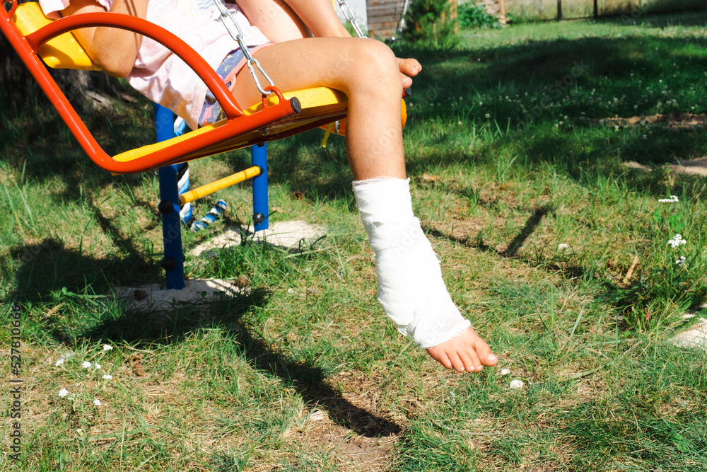 Children's legs are bandaged in plaster - barefoot on a swing ...