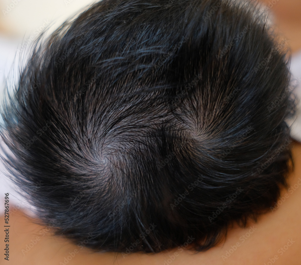 Asian child's head top view seeing black or dark brown hair with double ...