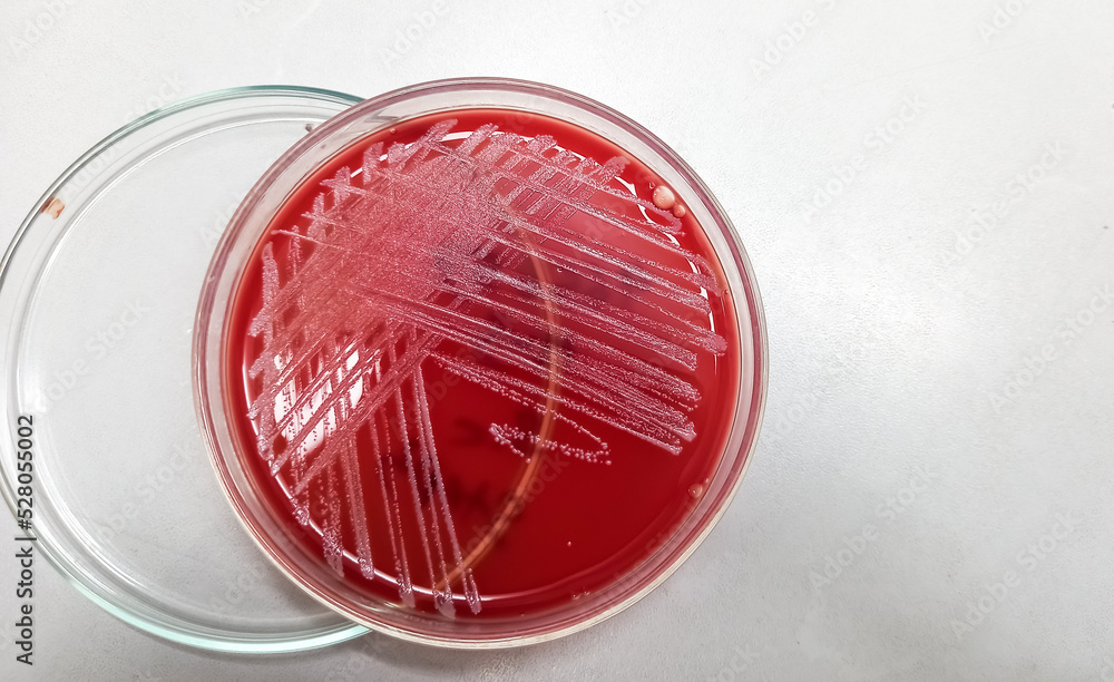 Blood agar medium growth of streptococcus, staphylococcus aureus, gram ...