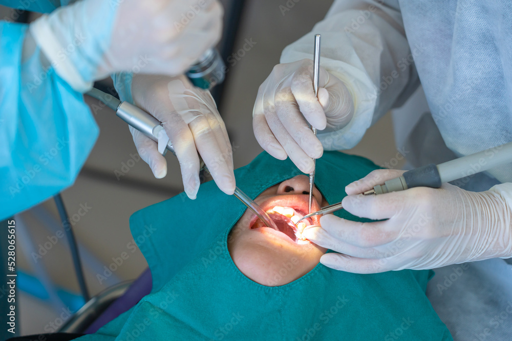 doctor cleaning the teeth patient with ultrasonic tool Stock Photo ...