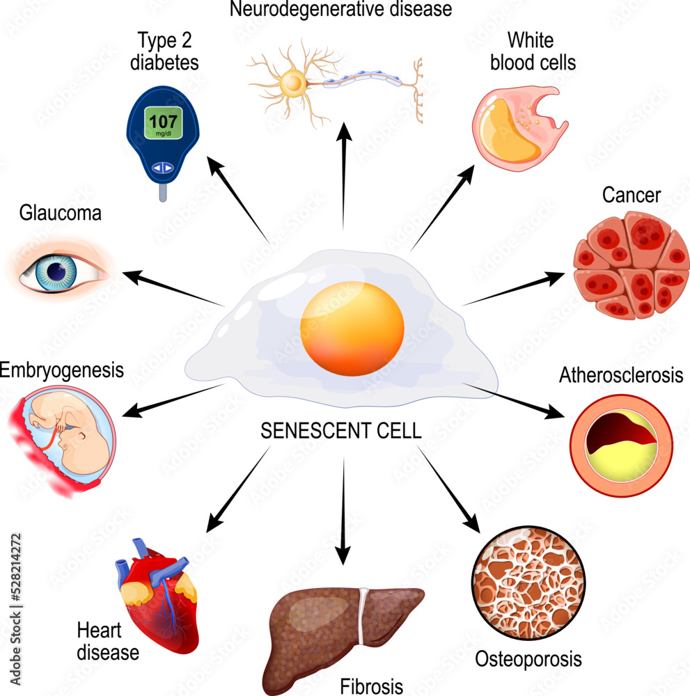 Cellular Senescence and health risks. roles that senescent cells play in the human body. Stock ...