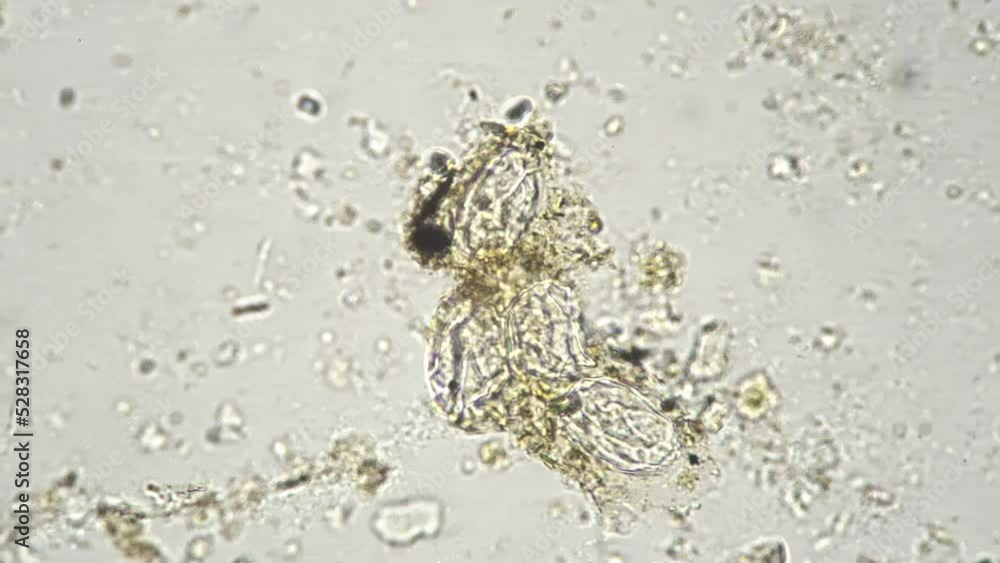 Video Stock Whole mount of Taenia solium eggs under microscope on white ...