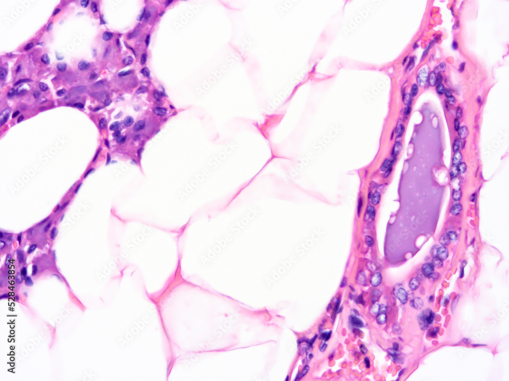 Histology of human tissue, show epithelial tissue and connective tissue ...