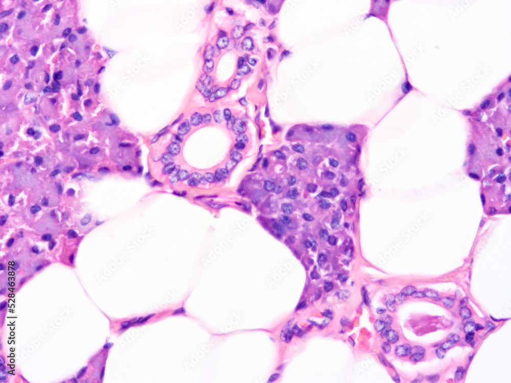 Histology of human tissue, show epithelial tissue and connective tissue ...