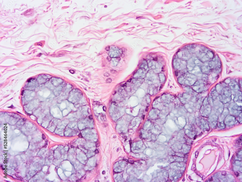 Histology of human tissue, show epithelial tissue and connective tissue ...