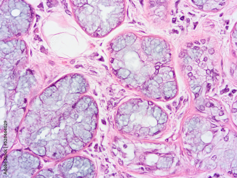 Histology of human tissue, show epithelial tissue and connective tissue ...