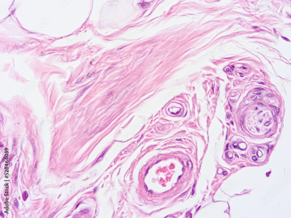 Histology of human tissue, show epithelial tissue and connective tissue ...