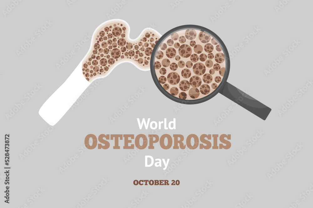 World Osteoporosis Day. Osteoarthritis of human anatomical bones ...