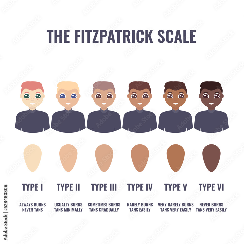 Fitzpatrick skin type classification scale shown in men. Human skin ...