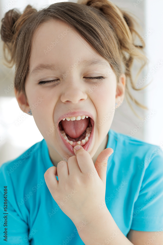 The child has lost a tooth. Little girl without a tooth. The first ...