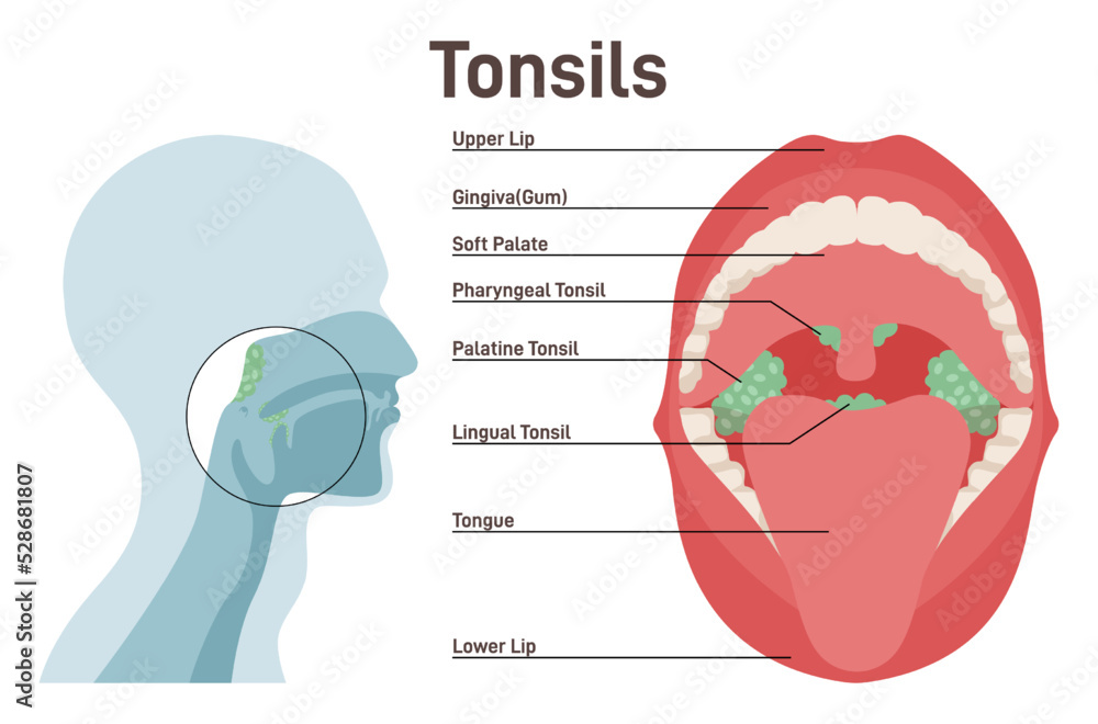 Tonsils. Human lymphoid organs. Immunocompetent organs at the back ...