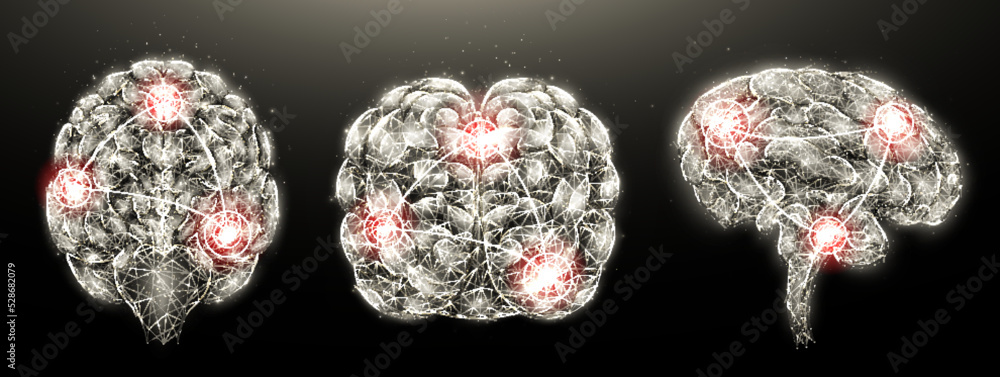 Polygonal illustration of human brain inflammatory disease on a dark ...