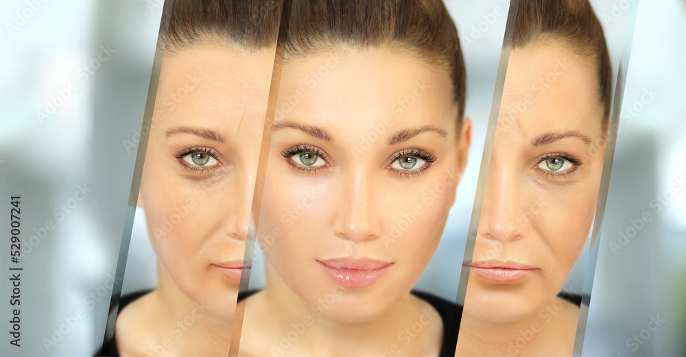 Aging. Mature woman-young woman.Face with skin problem.Showing photos ...