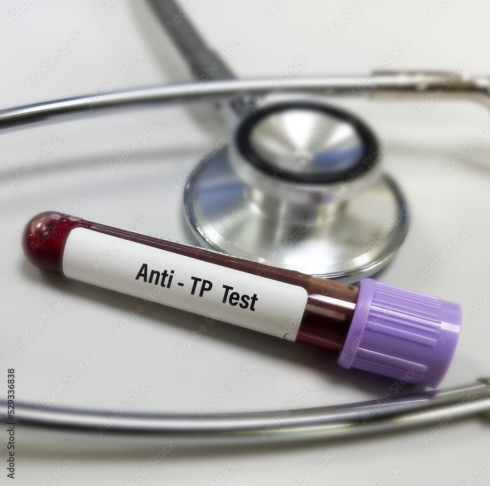 Blood sample for Anti-TP(Treponema pallidum) test. Diagnosis Syphilis ...