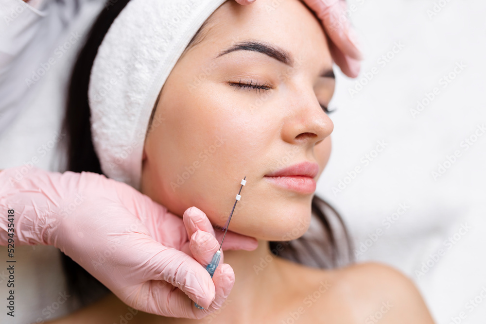 Face lifting PDO Suture operation. innovative technique of New thread ...