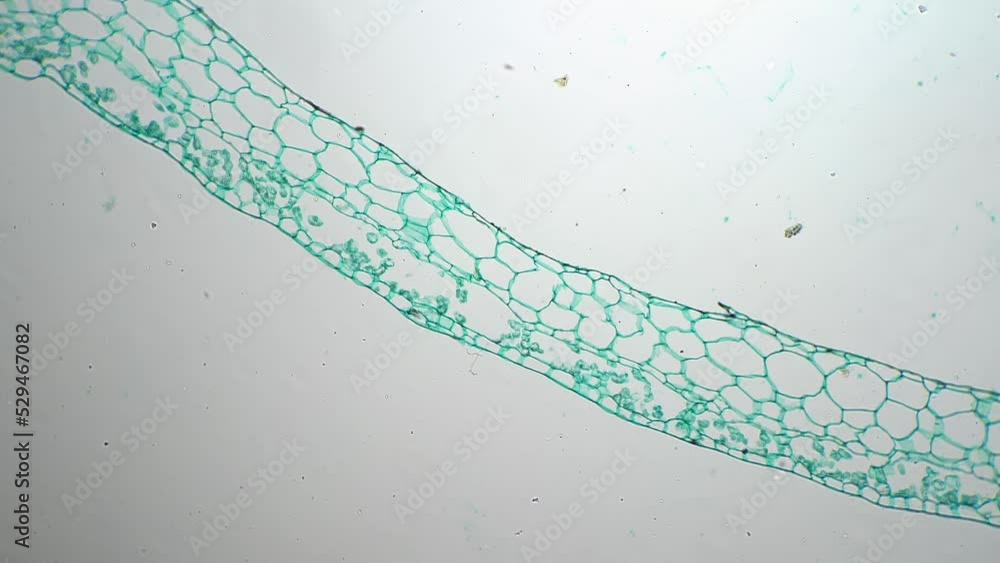 Frond of Marchantia section under magnified under microscope in 100 ...