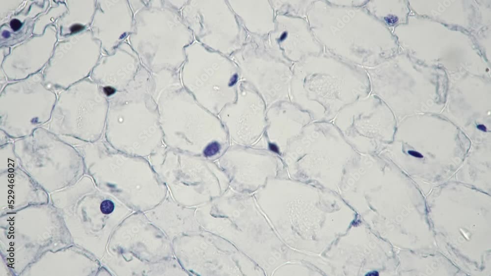 Ovary of Lilium in transversal section under microscope 400x against ...