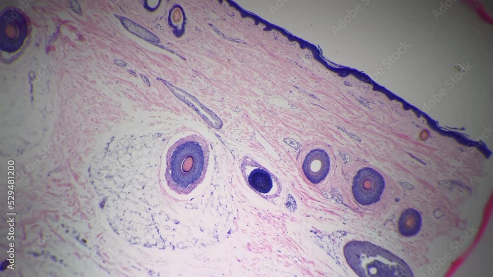 Skin of human shown with hair follicles in section filmed under ...