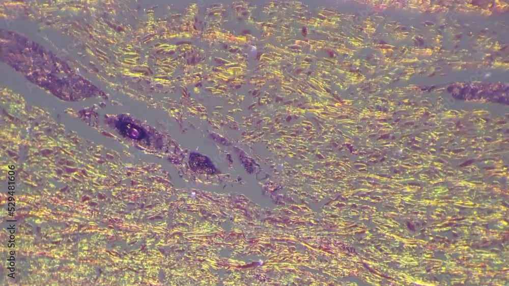 Sweat glands on human skin filmed under microscope 40x with oblique ...