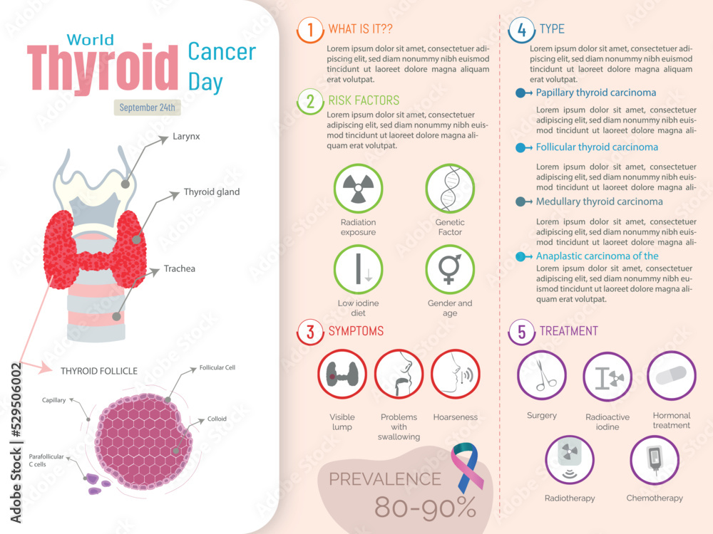 Vetor de World Thyroid Cancer Day,Thyroid disease infographic.Symptoms ...