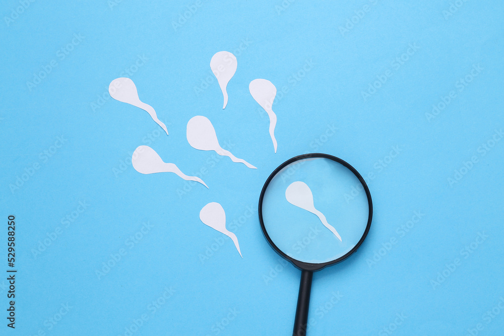 Diagnosis of male reproductive function. Spermatozoa, male seed with a ...