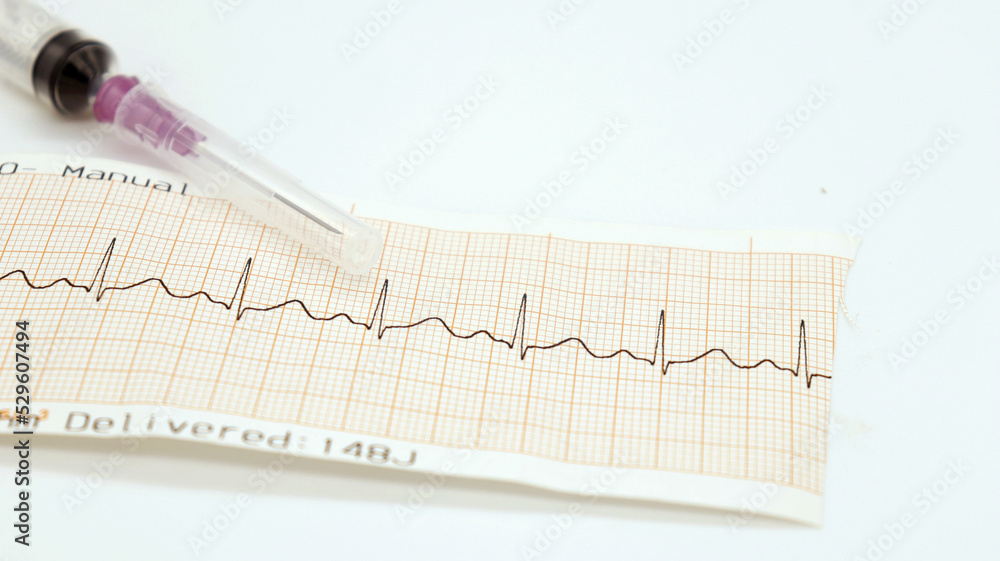 ekg paper showing ECG results on a white background Stock Photo | Adobe ...