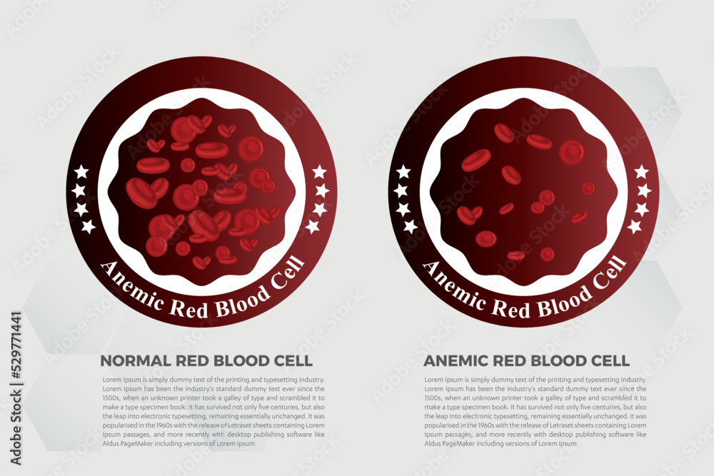 Anemia Iron red blood cell medical vector illustration medical. Stock ...