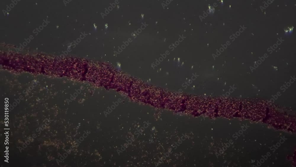 Stockvideon Lab slide with three types of bacteria magnified in 200 ...