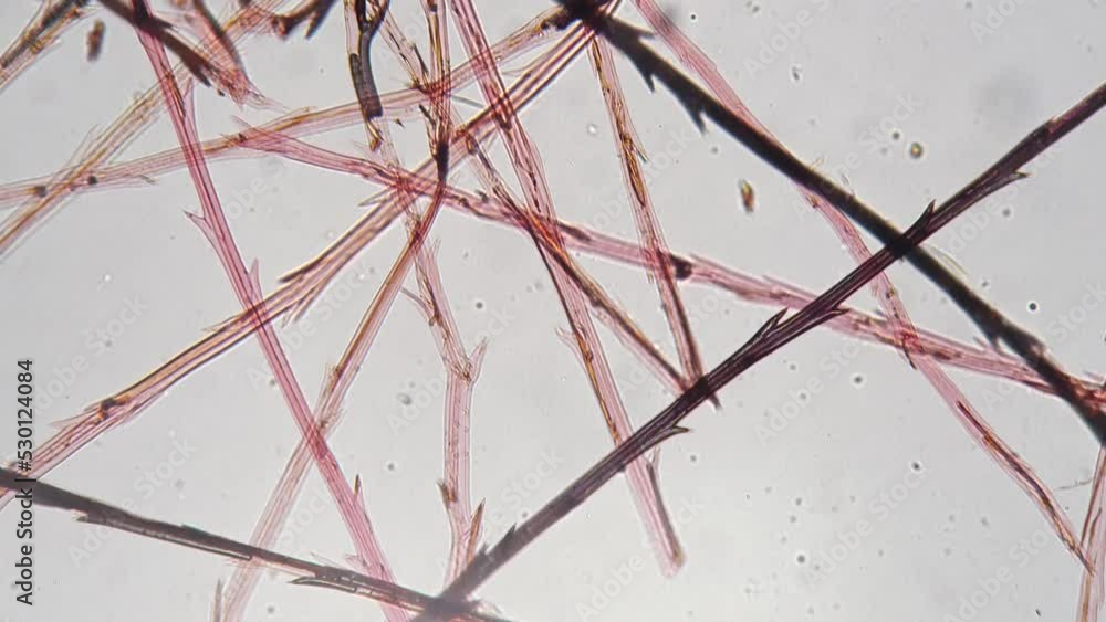 Dandelion fuzz whole mount magnified under microscope in 200 times on ...