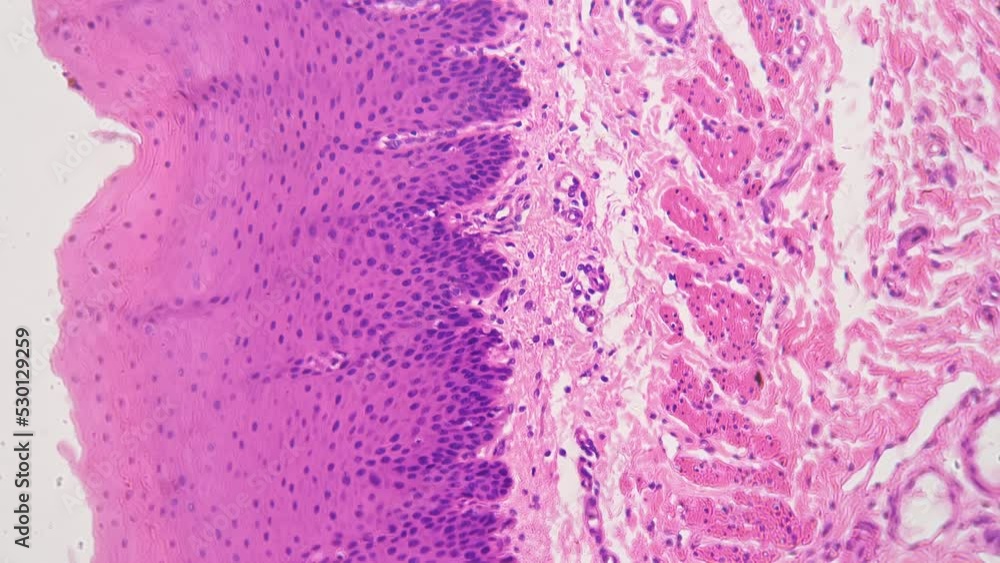 Stratified squamous epithelium filmed by microscope with 200x against ...