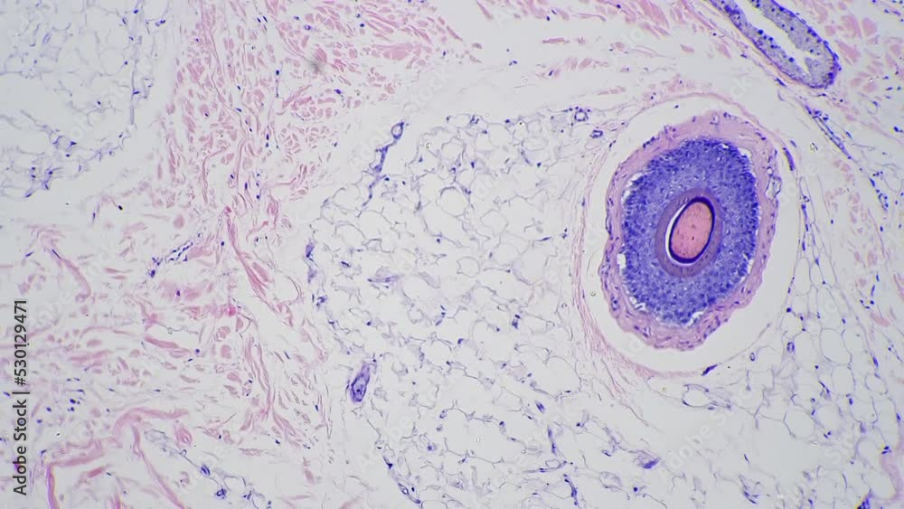 Human skin shown with hair follicles in section under microscope with ...