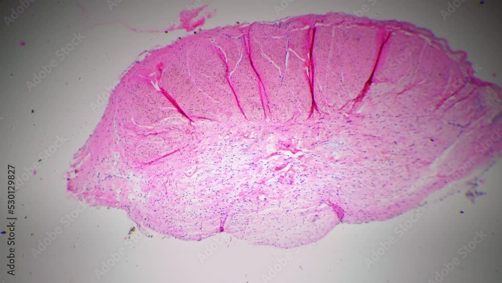 Dense connective tissue in longitudinal section under microscope 40x on ...
