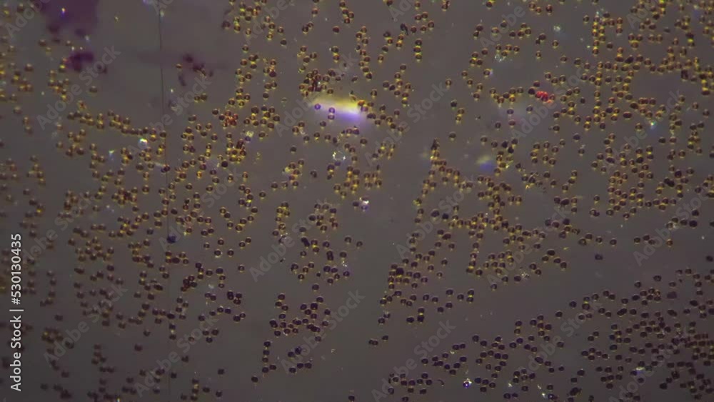 Blood of human smear filmed with oblique illumination under microscope ...