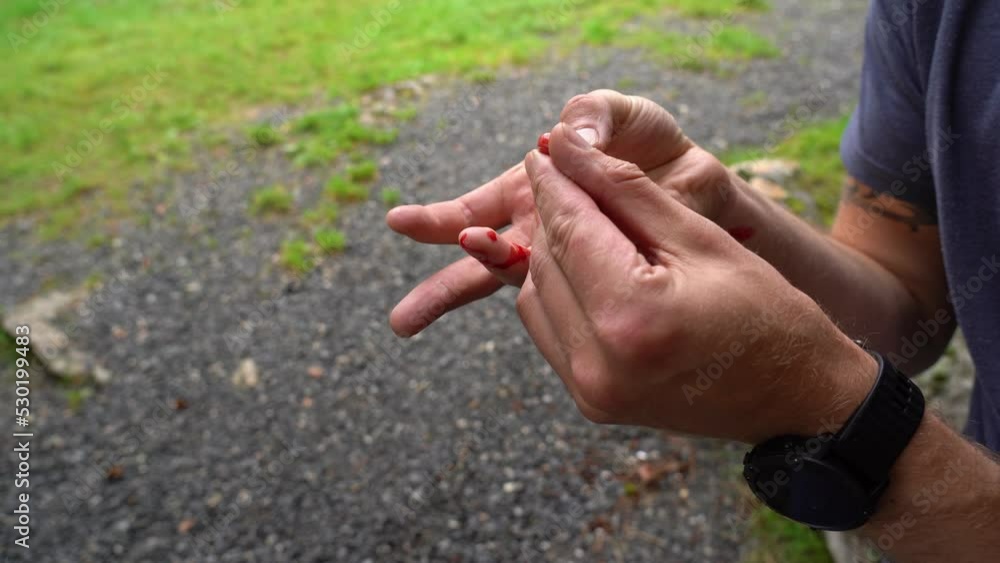 Man in nature cut his little finger and is squeezing his wound in front ...
