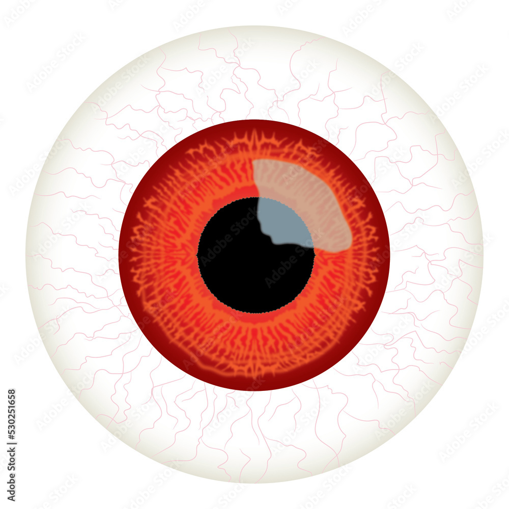 realistic human eyeball. Eye with bright red, illustration of eye ball ...